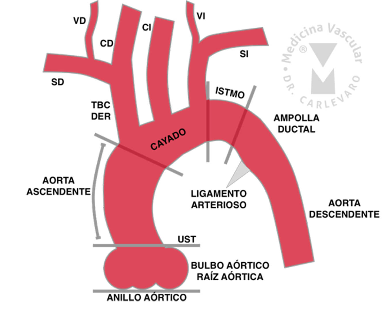 Aorta torácica: sus segmentos y sus ramas principales - Medicina Vascular